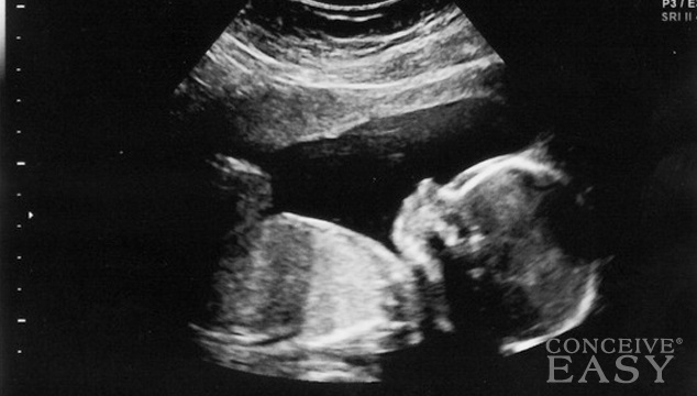 The scientific definition of life is when one, two, or all three of the ...